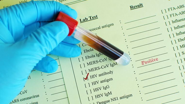De soa-test moet in het basispakket | De Volkskrant