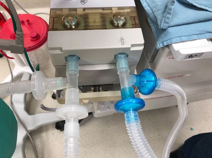 Utiliser un respirateur pour plusieurs patients différents? “Ça ...